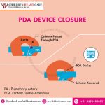Best PDA Surgery in Delhi - Dr. Gaurav Agrawal